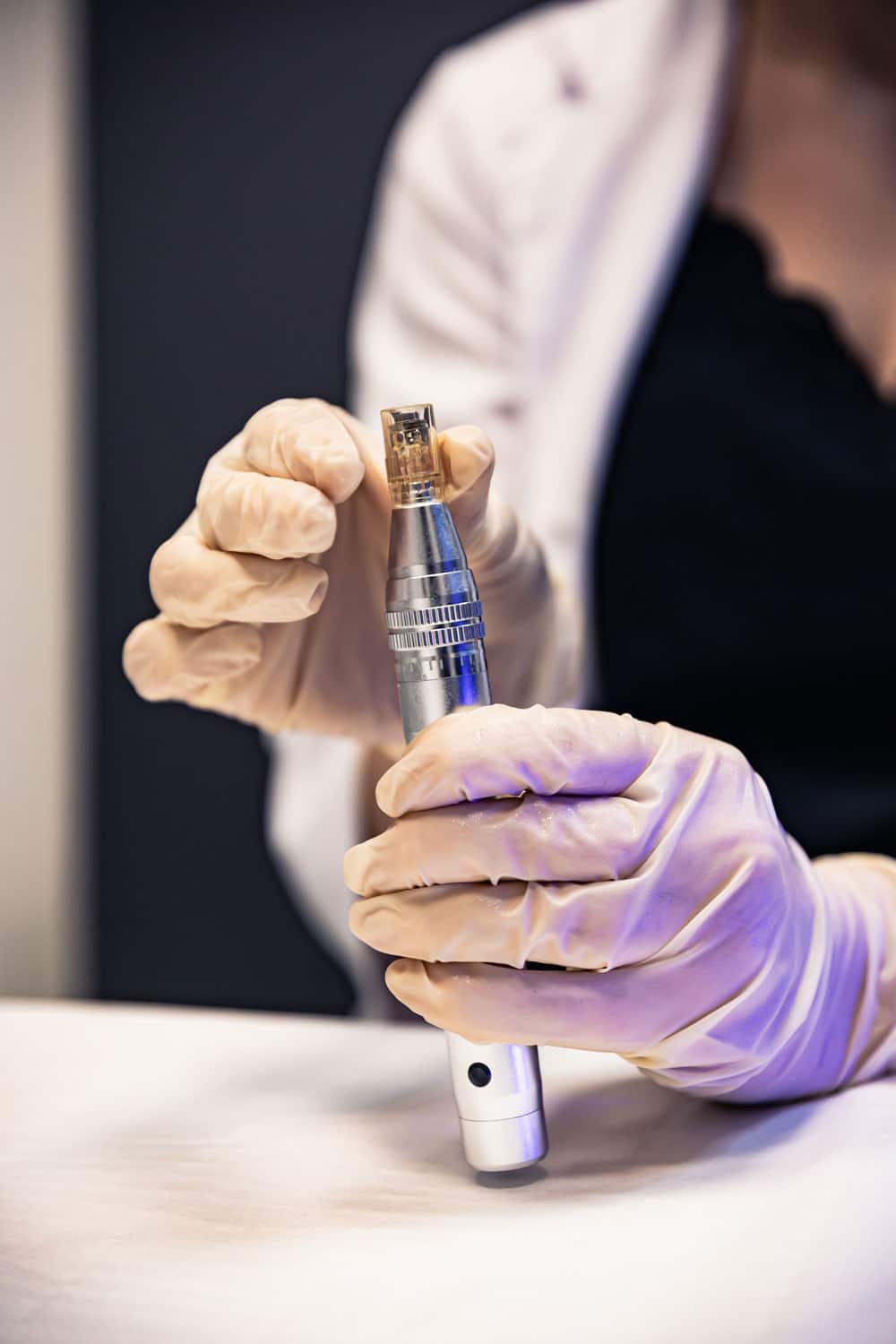 Le microneedling : un traitement pour enlever les vergetures | DermaPro ...